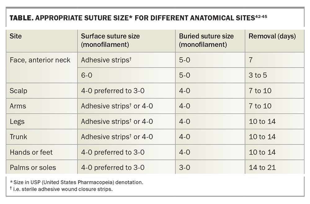 Sutures And Their Uses